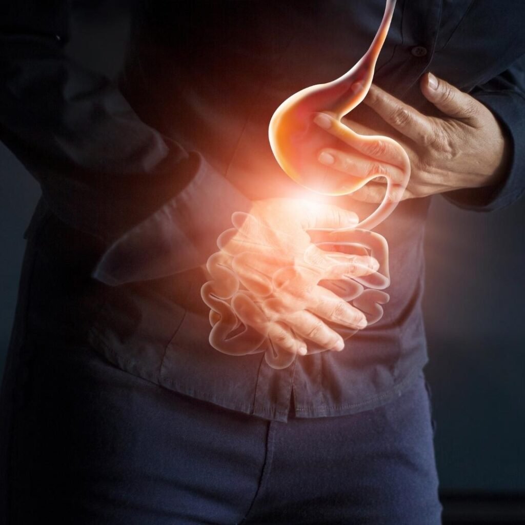 Compounded Medications for Ulcerative Colitis - AllMedRx